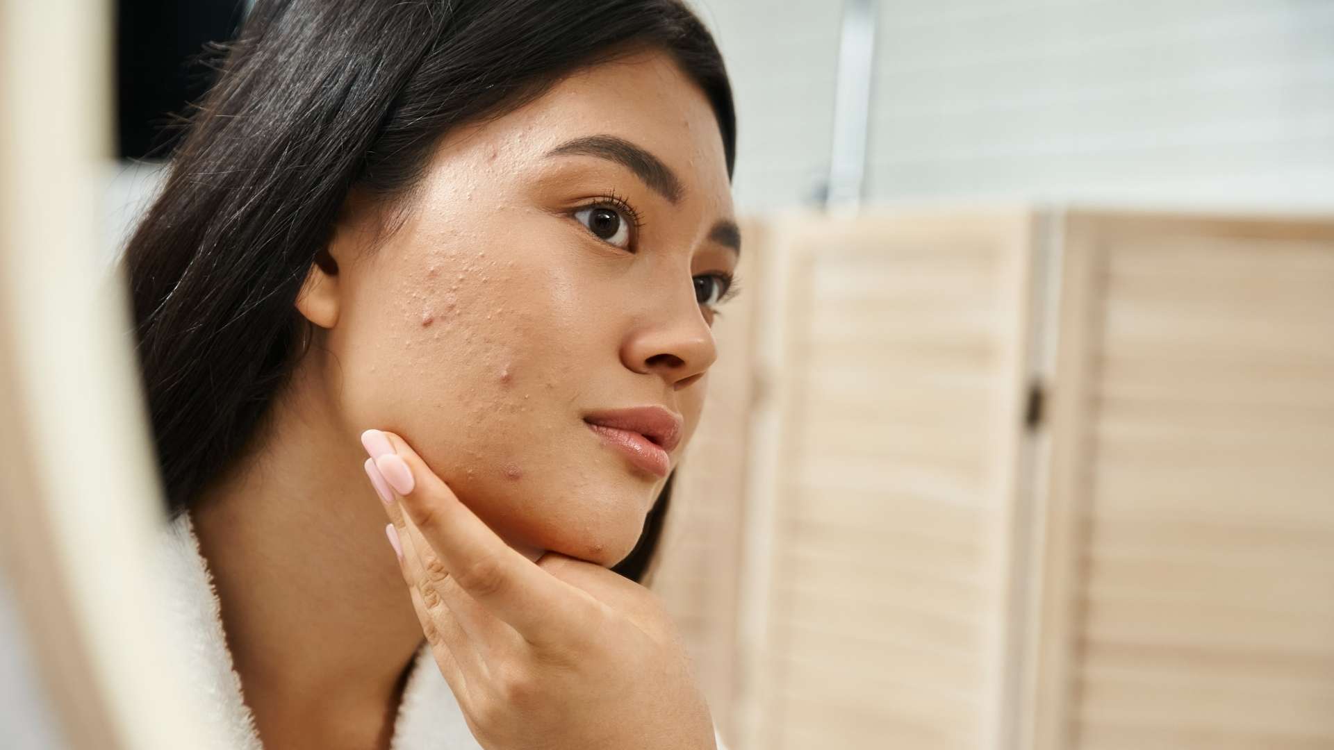 How To Treat Fungal Acne On Face: Expert Tips From Dermatologists